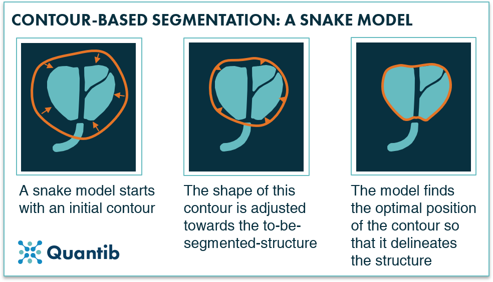 Deep learning applications in radiology: image segmentation